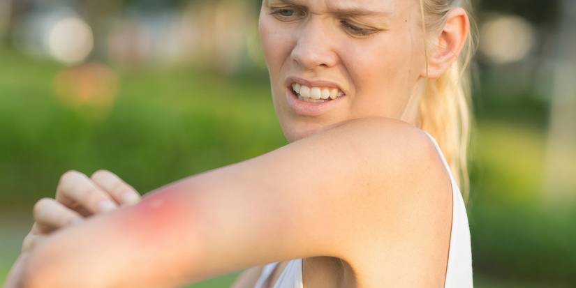 Stung in the Garden? Here's What to Do