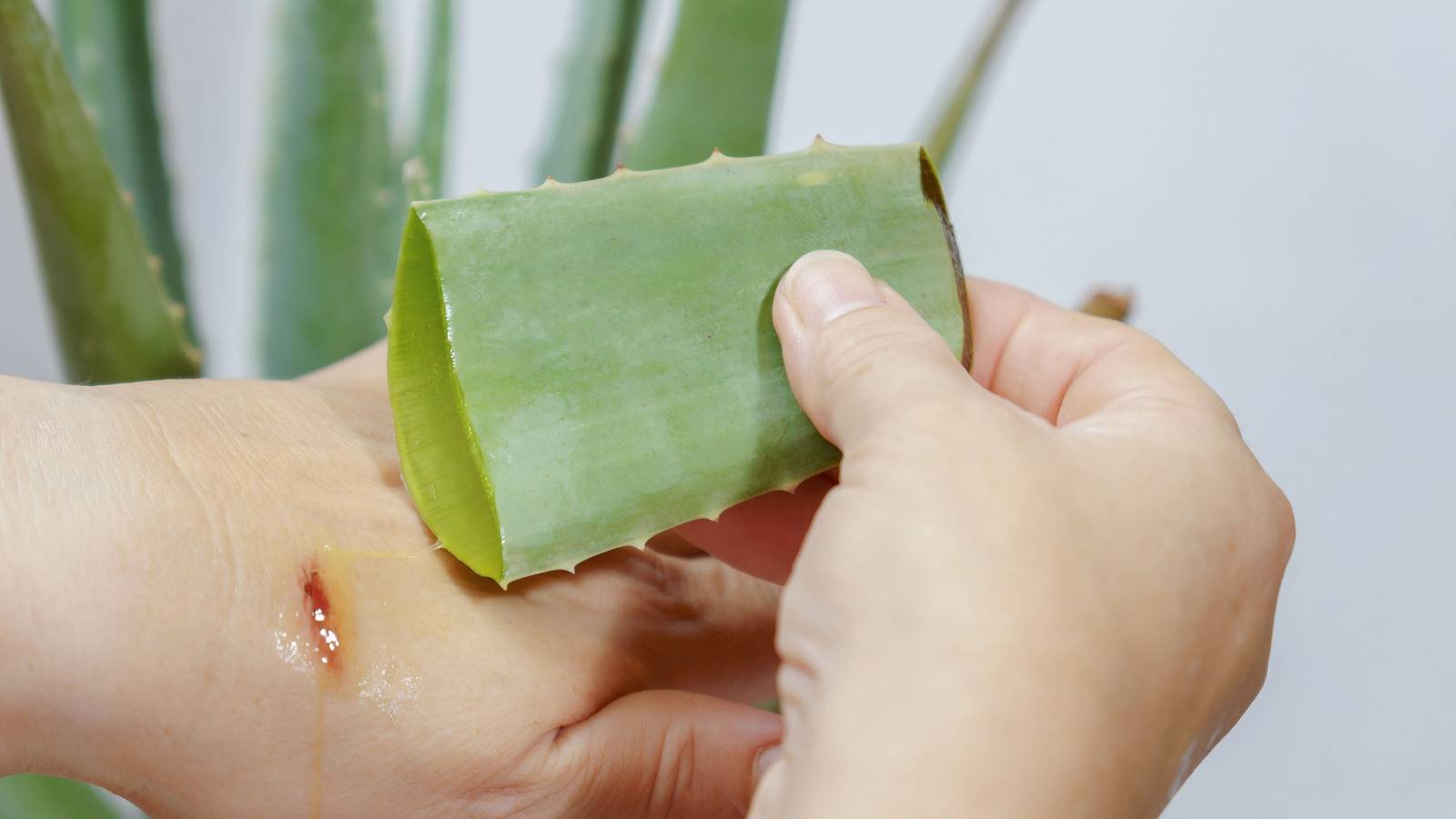 7 Healing Plants That Naturally Treat Burns and Soothe Skin